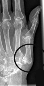 01 – Handchirurgie Dr. Paul Preisser